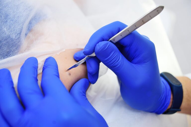 Chirurgie dermatologique à Nantes | Dr François Ruiz
